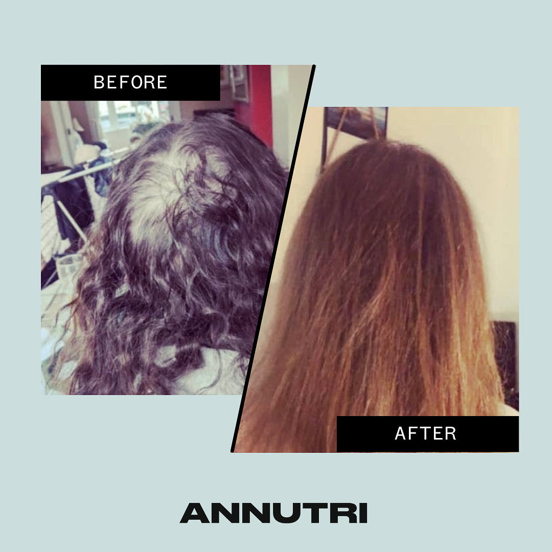 Hair Growth Supplement Reviews & Hair Growth Results – annutri